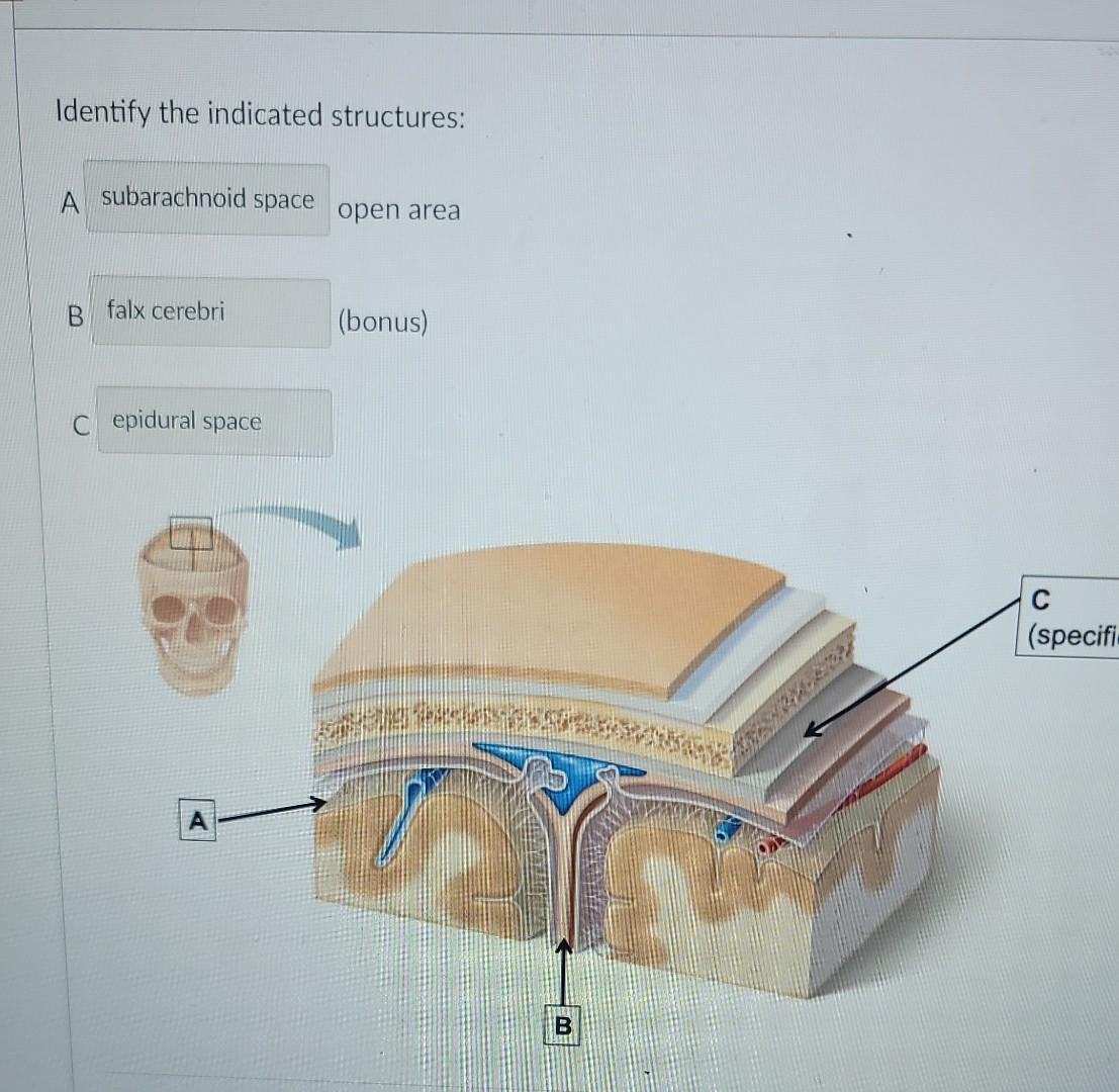 Solved Identify the indicated structures: A subarachnoid | Chegg.com