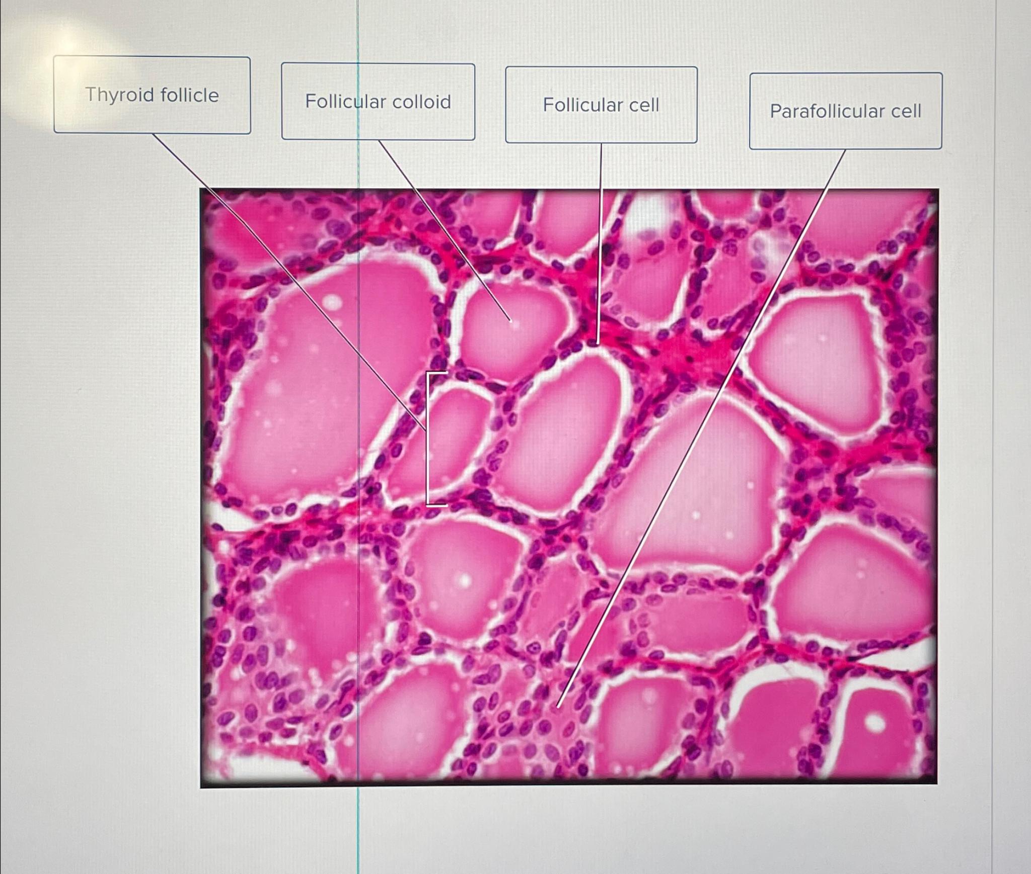 Solved Identifying thyroid gland histology | Chegg.com