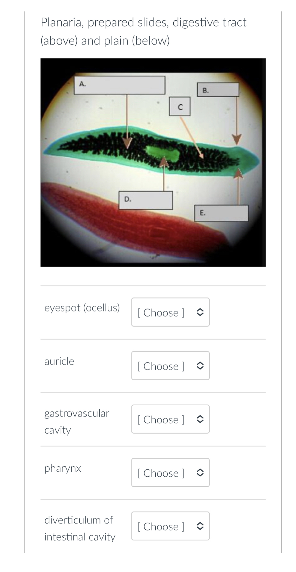 Planaria, prepared slides, digestive tract (above) | Chegg.com