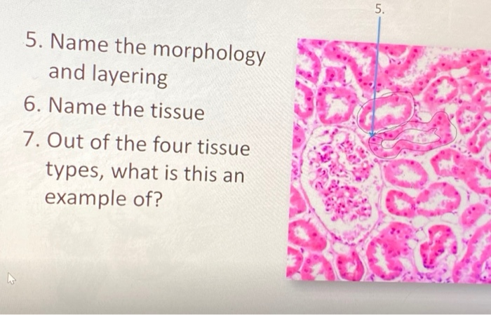 Solved 5. 5. Name the morphology and layering 6. Name the | Chegg.com