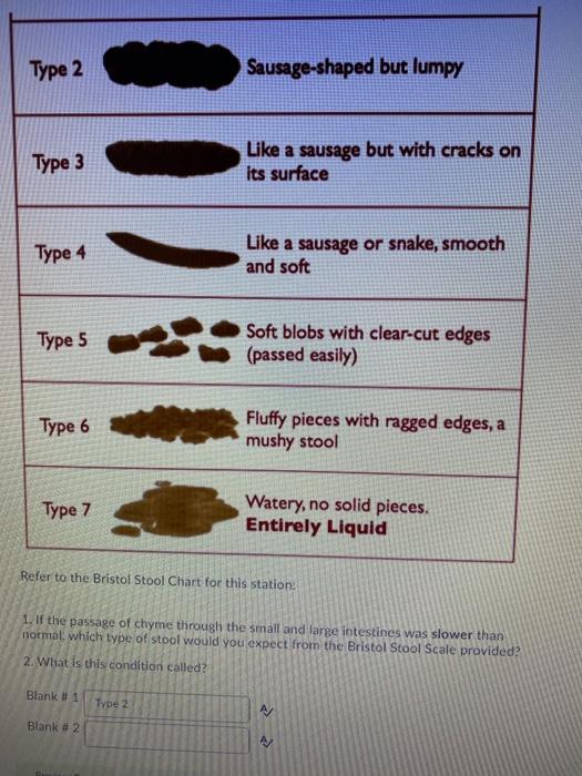 Solved Type 2 Sausage-shaped but lumpy Type 3 Like a sausage | Chegg.com