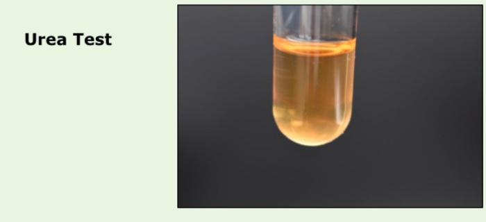 Solved Urea Test | Chegg.com
