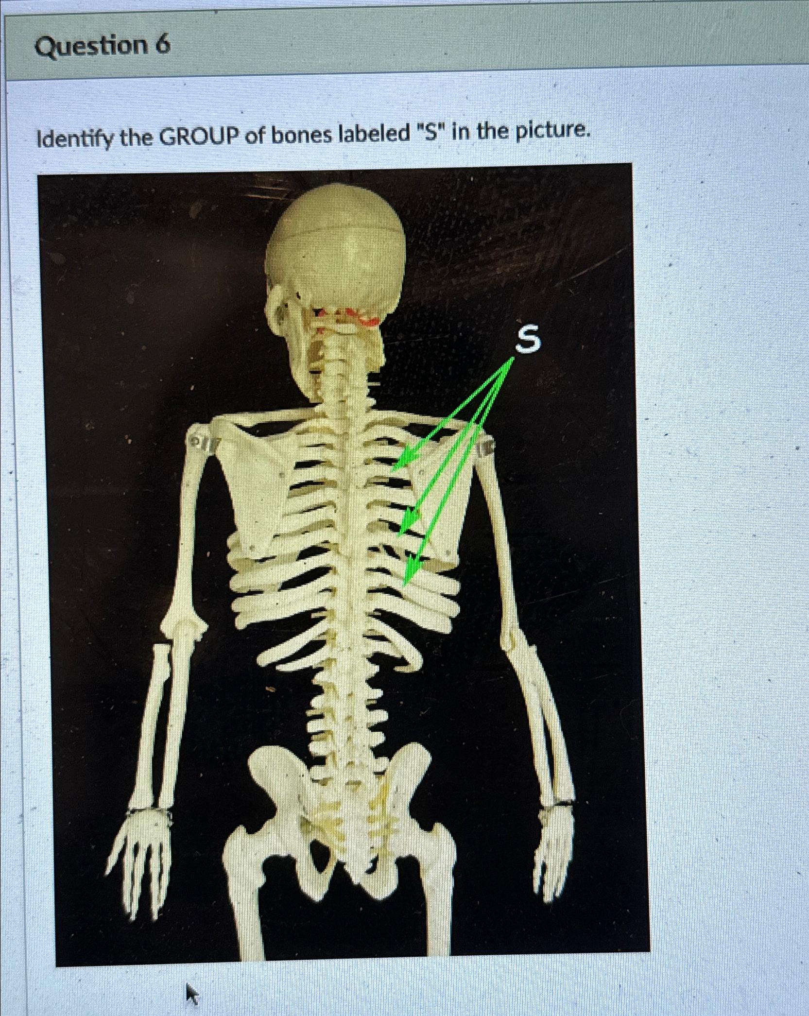 Solved Question 6Identify the GROUP of bones labeled "S" ﻿in | Chegg.com