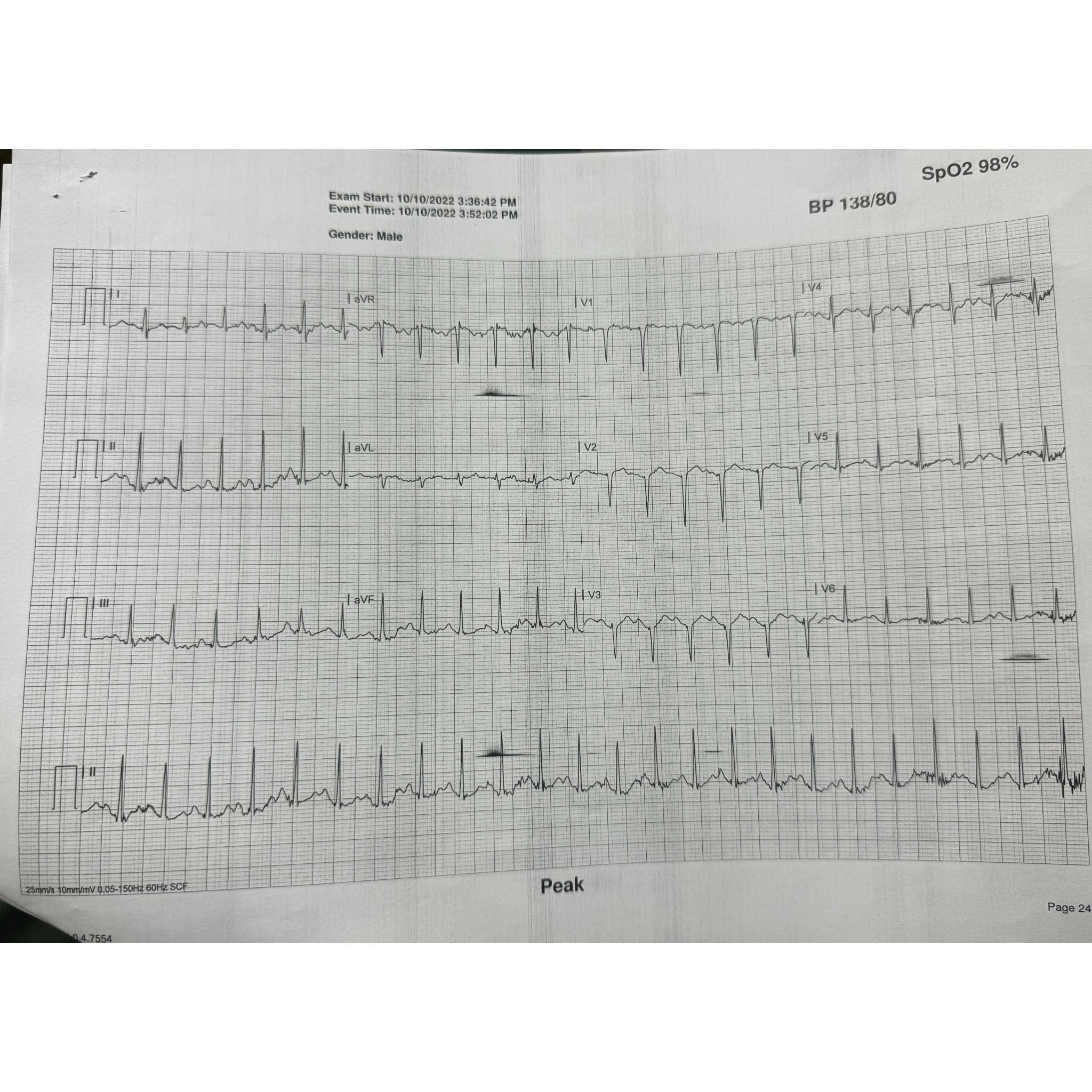 Solved Interpret the GXT results - ﻿include max METs | Chegg.com
