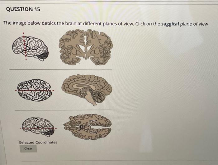 Solved The image below depics the brain at different planes | Chegg.com