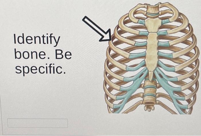 Solved Identify bone. Be specific. | Chegg.com