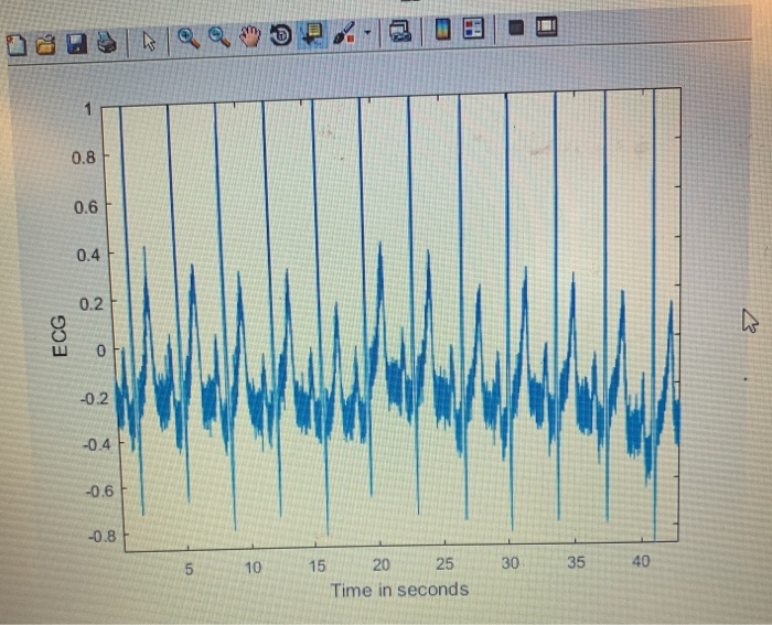 % MATLAB PROGRAM ECG_plot.m% Use this program to read | Chegg.com
