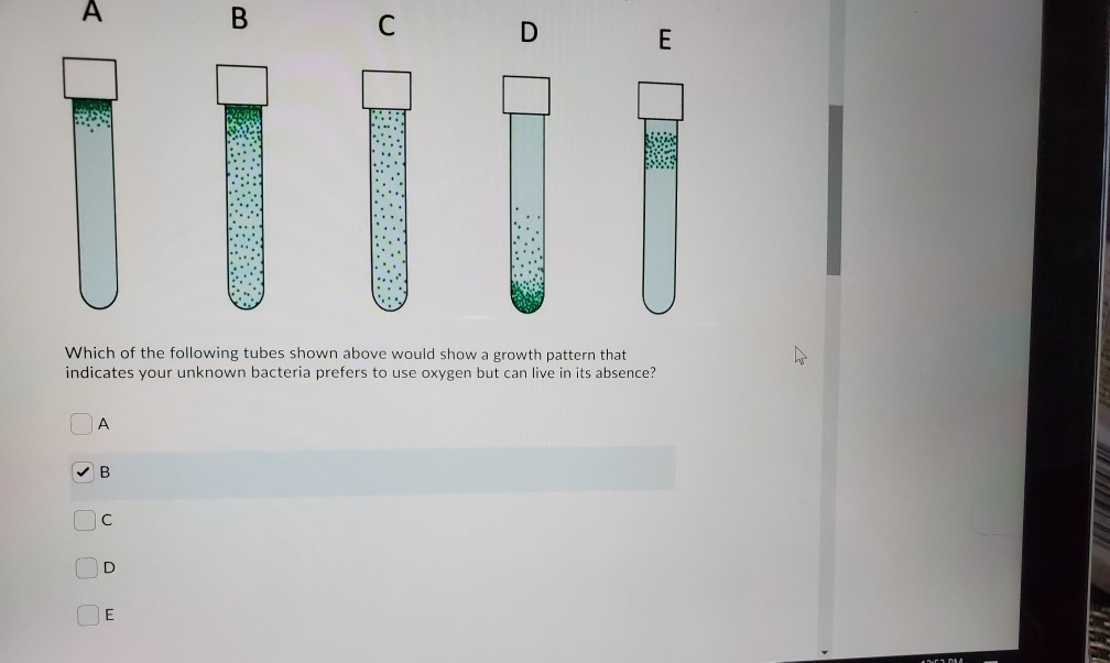 Solved OBD BBL™ DrySlide test and a positive The test | Chegg.com