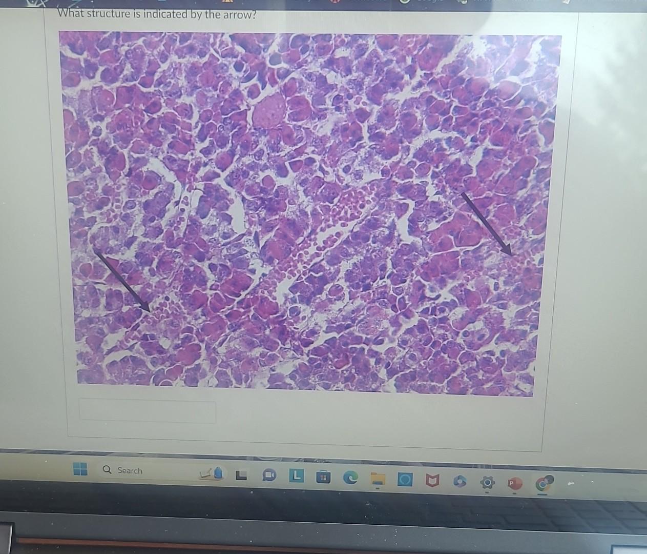 Solved What structure is indicated by the arrow? | Chegg.com
