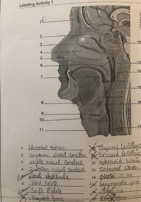 Labeling Activity 1 1. fRombel sinus to Thunaid | Chegg.com