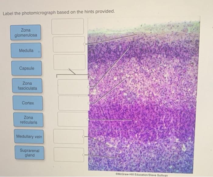 Solved Label the photomicrograph based on the hints | Chegg.com