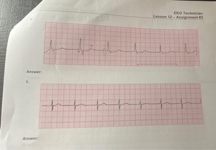 Solved Lesson 12 Assignment #2: Basic EKG Interpretation | Chegg.com