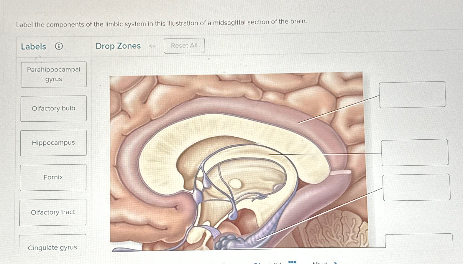 Solved Label the components of the limbic system in this | Chegg.com
