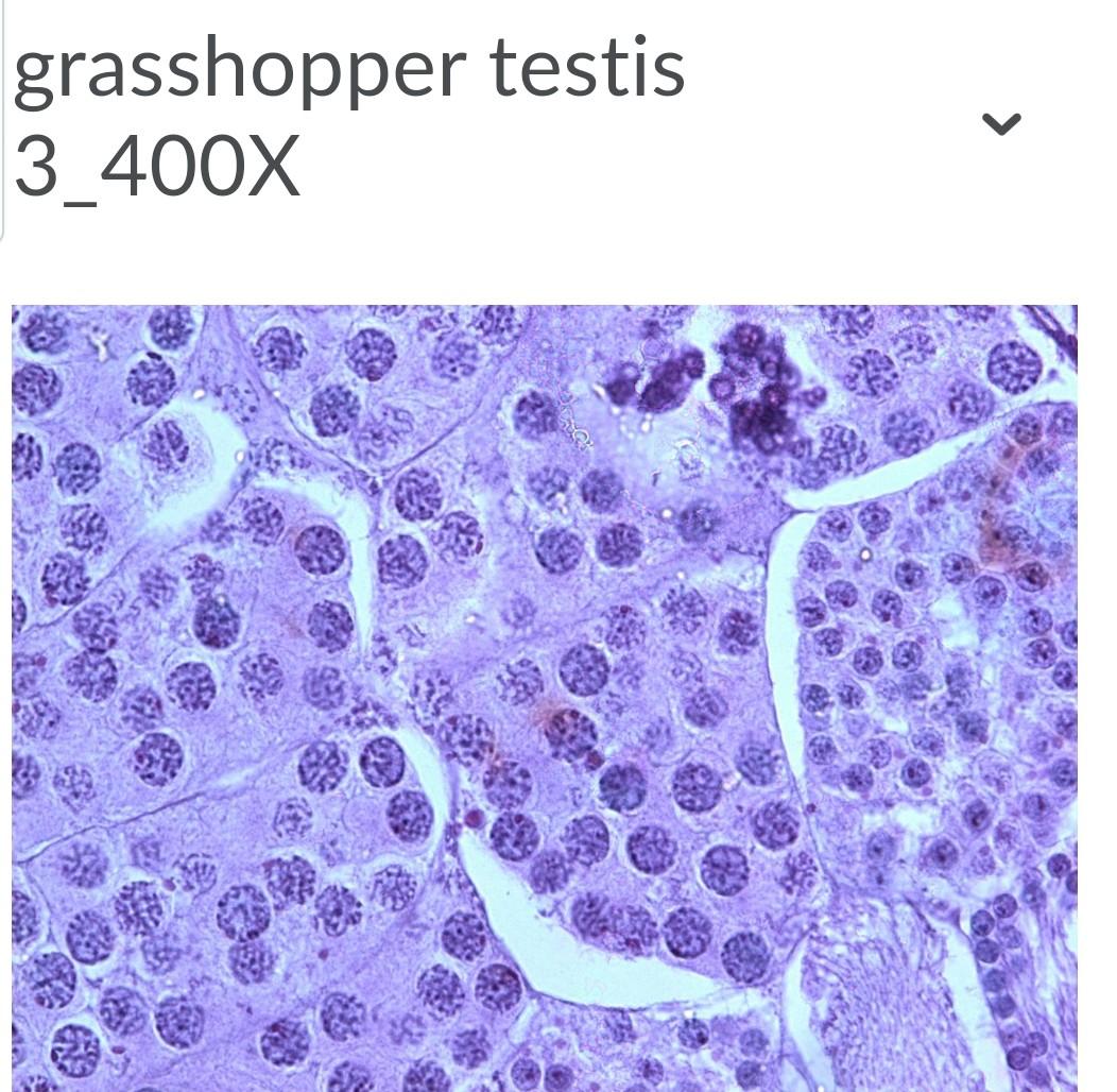 Solved grasshopper testis 3_100X
