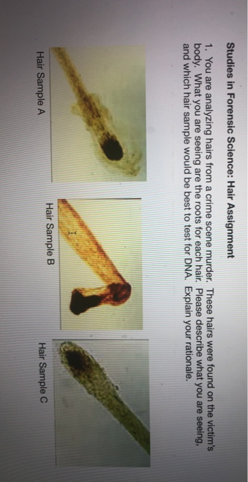 Solved Studies in Forensic Science: Hair Assignment 1. You | Chegg.com
