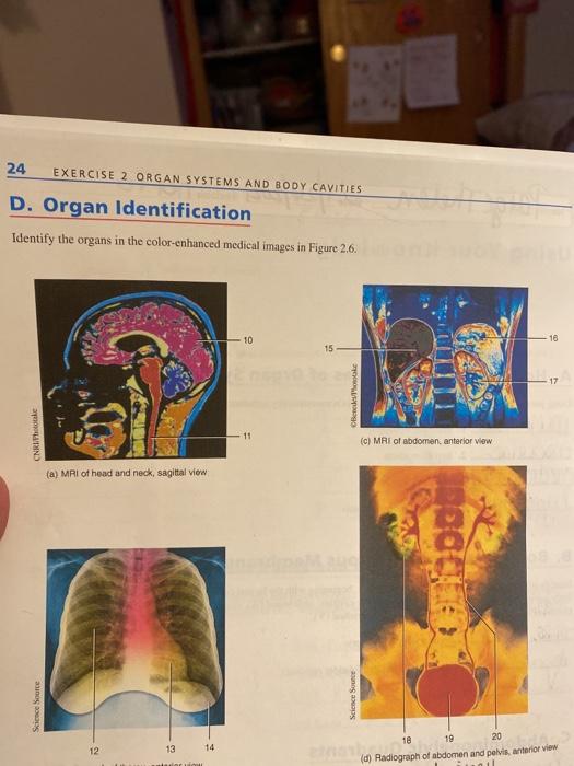 Solved 24 EXERCISE 2 ORGAN SYSTEMS AND BODY CAVITIES D. | Chegg.com