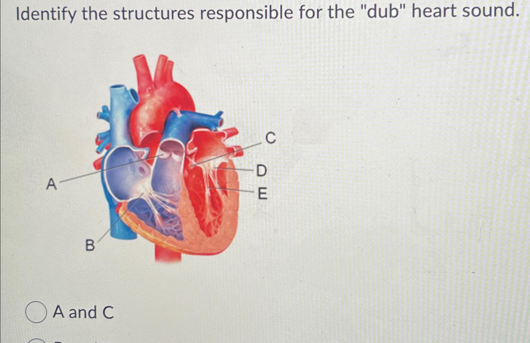 Solved Identify the structures responsible for the "dub" | Chegg.com