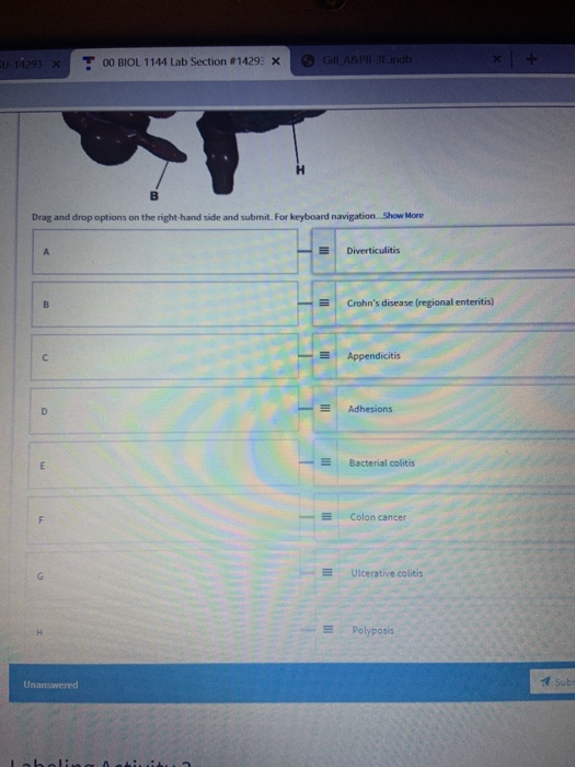 Solved Labeling Activity 2 Matching Activity 2 Homework. | Chegg.com