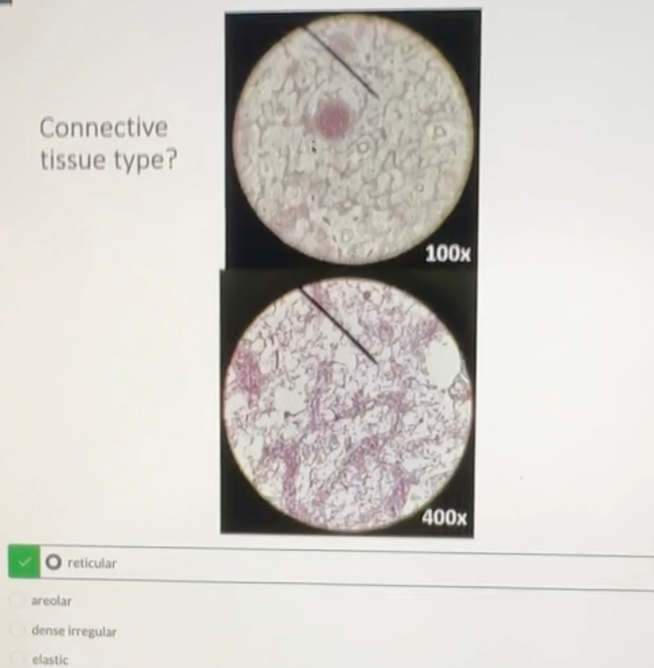 Solved Connective tissue type?reticularareolardense | Chegg.com