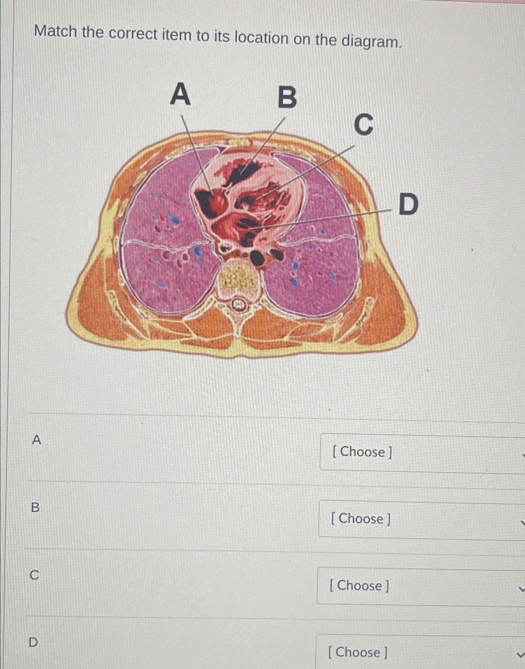 Solved Match the correct item to its location on the | Chegg.com