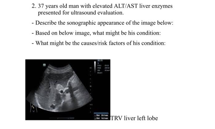 Solved 2. 37 years old man with elevated ALT/AST liver | Chegg.com