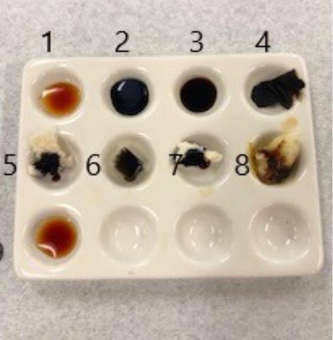 Solved 1 2 4 Figure 11 - Iodine Test for Starch Well ID | Chegg.com