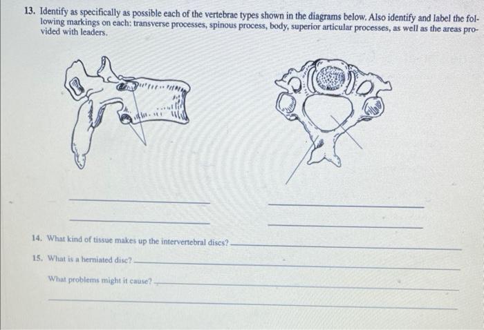 Solved 12. The distinguishing characteristics of the | Chegg.com