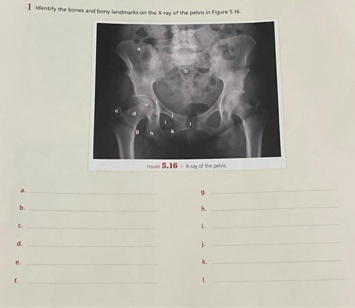 Solved 1 identify the bones and bony landmarks on the X-ray | Chegg.com