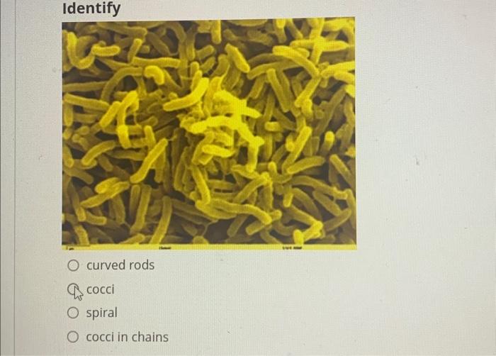 Solved Idpntify curved rods cocci spiral cocci in chains | Chegg.com