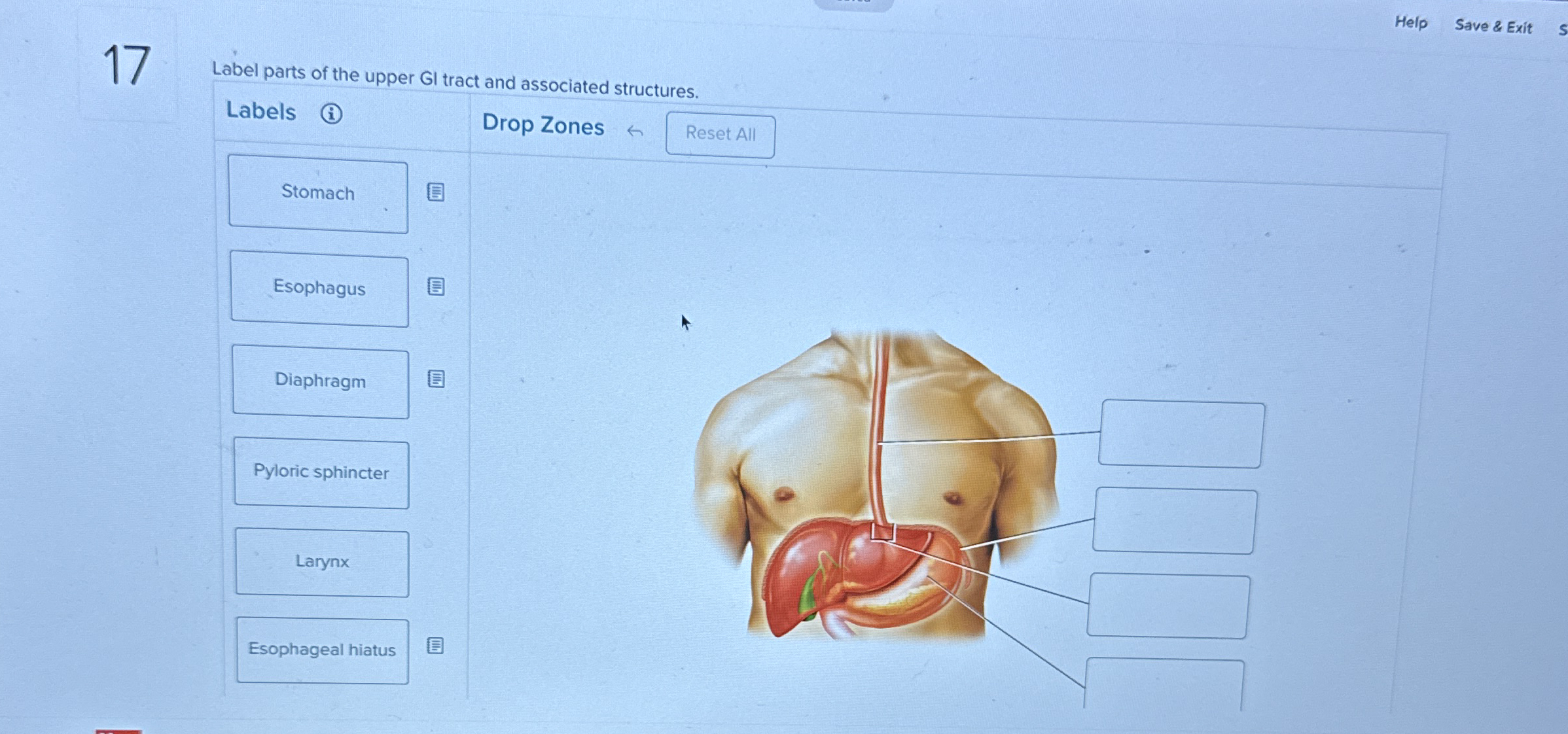 Solved HelpSave & Exit17Label parts of the upper GI tract | Chegg.com