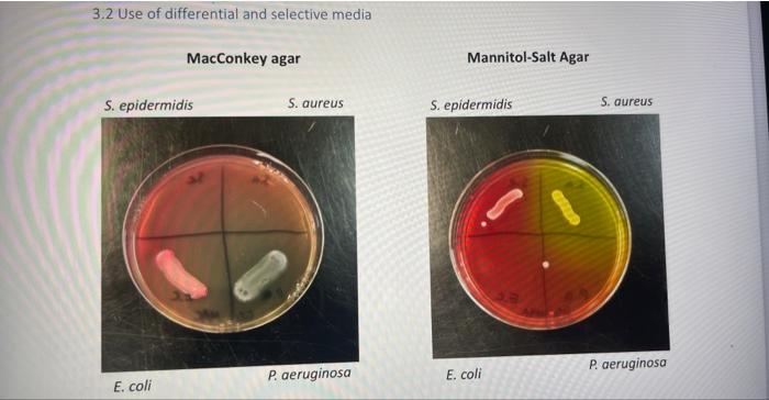 Solved 3.2 Use of differential and selective media MacConkey | Chegg.com