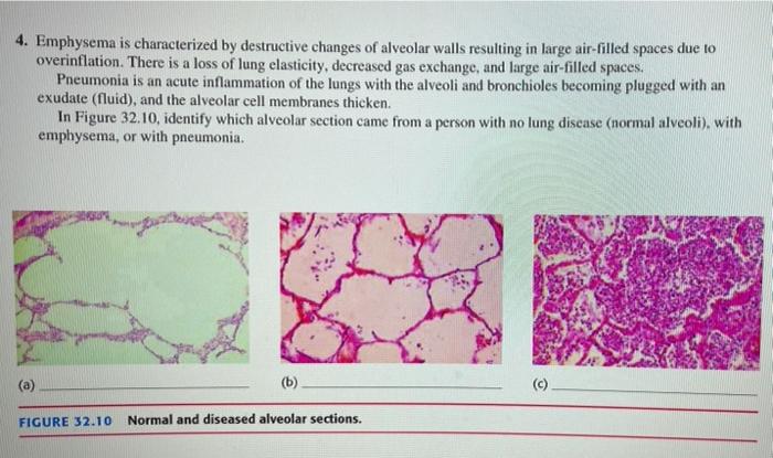 Solved EXERCI Using Your Knowledge 32 A. Anatomy of the | Chegg.com