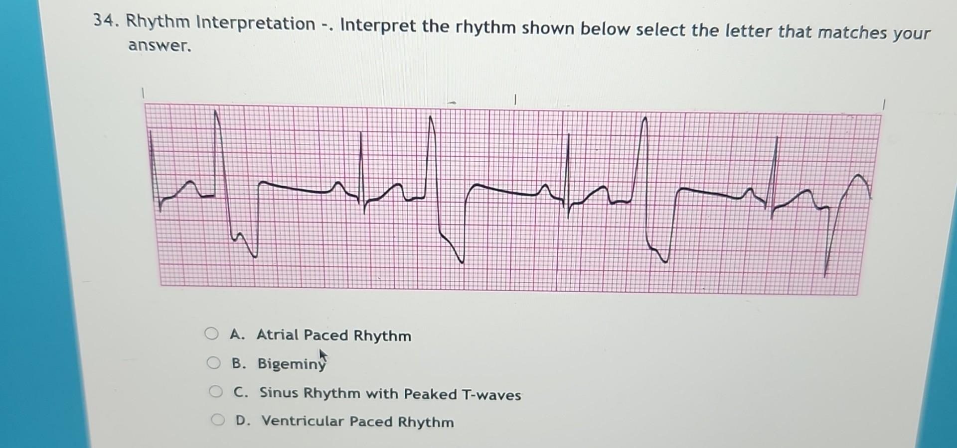 Solved 34. Rhythm Interpretation -. Interpret the rhythm | Chegg.com