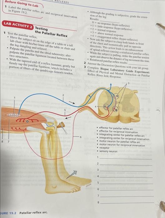 Solved EFLEXES Before Going to Lab 1 Label the patellar | Chegg.com