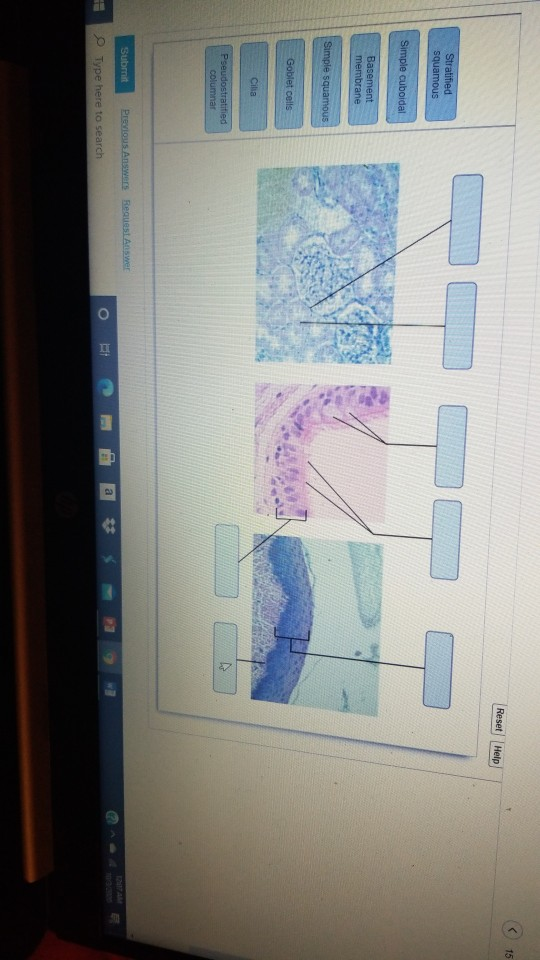 Solved 15 Reset Help Stratified squamous Simple cuboidal | Chegg.com