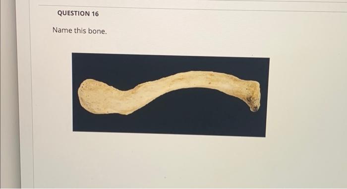 Solved QUESTION 16 Name this bone. | Chegg.com