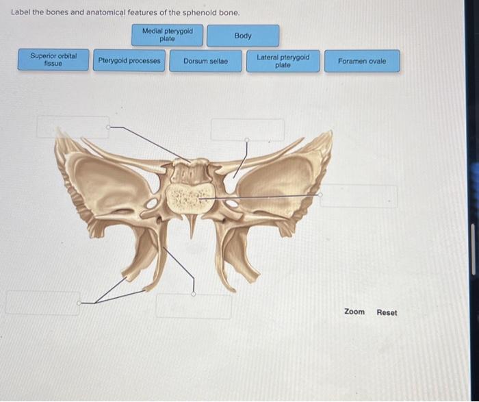 Solved Label the bones and anatomical features of the | Chegg.com
