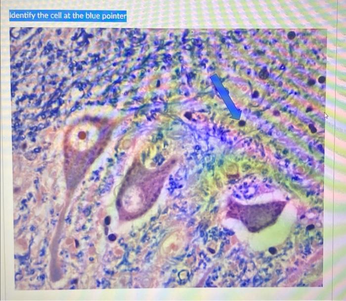Solved Identify the cell at the blue pointer | Chegg.com