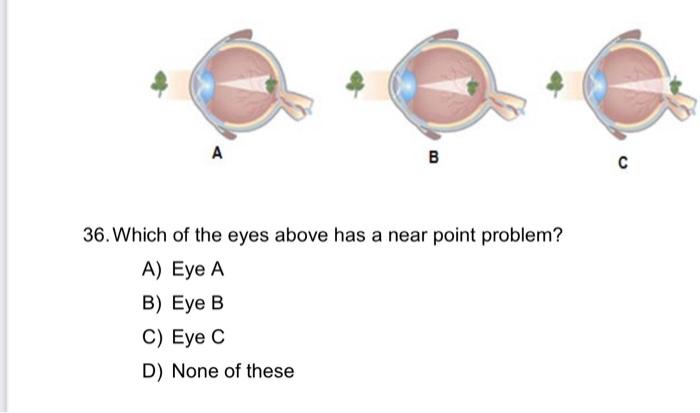 Solved 36. Which of the eyes above has a near point problem? | Chegg.com