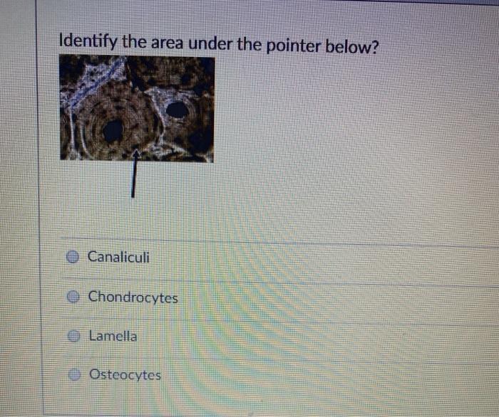 Solved Identify the area under the pointer below? Canaliculi | Chegg.com