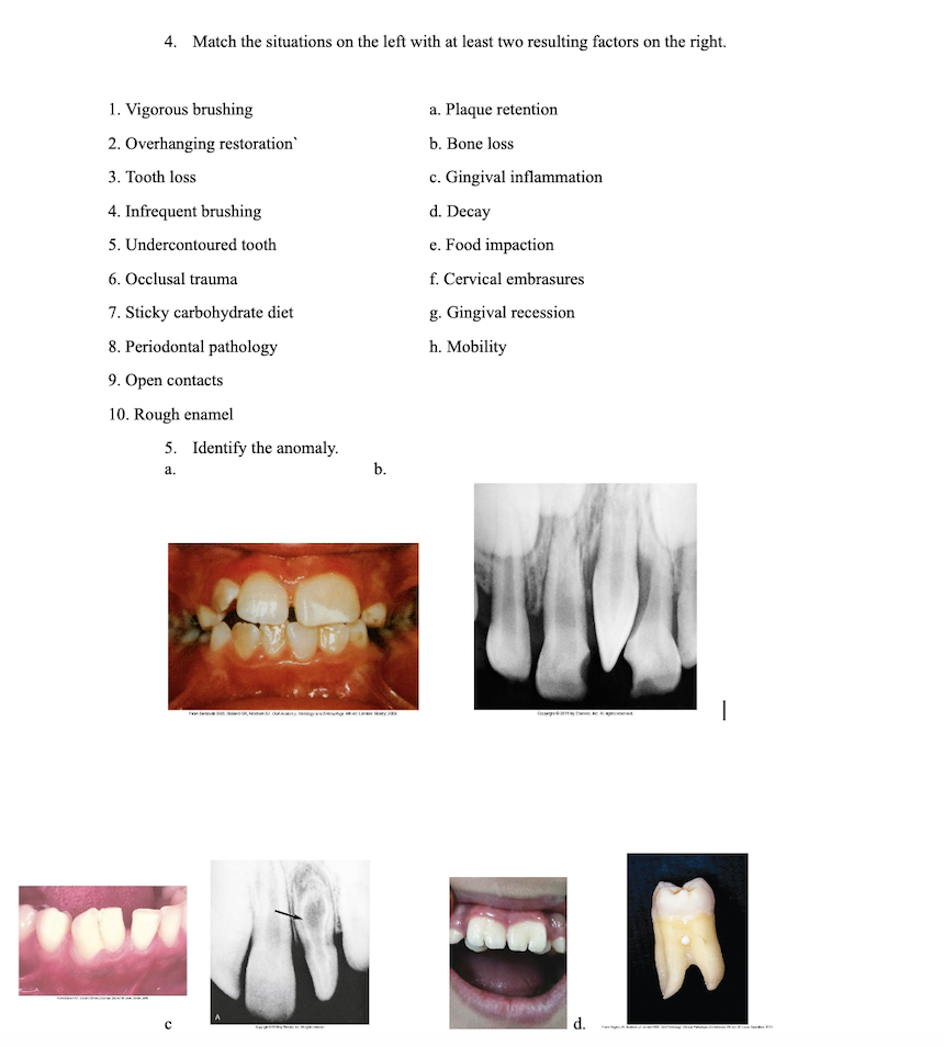 Solved 1. ﻿Vigorous brushing | Chegg.com