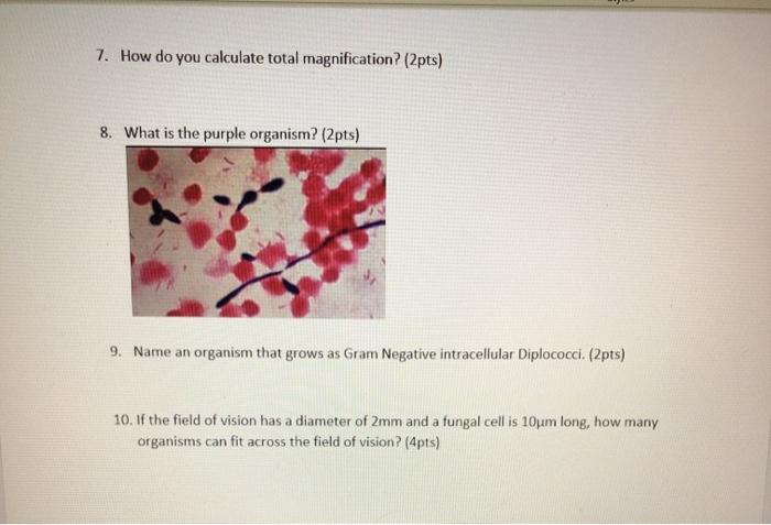 Solved 7. How do you calculate total magnification? (2pts) | Chegg.com