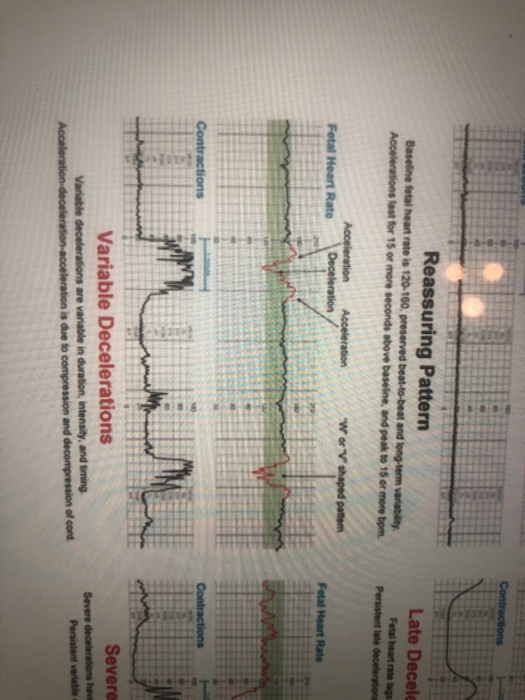 Solved Fetal Monitor Patterns Near Cocos Reassuring Pattern | Chegg.com
