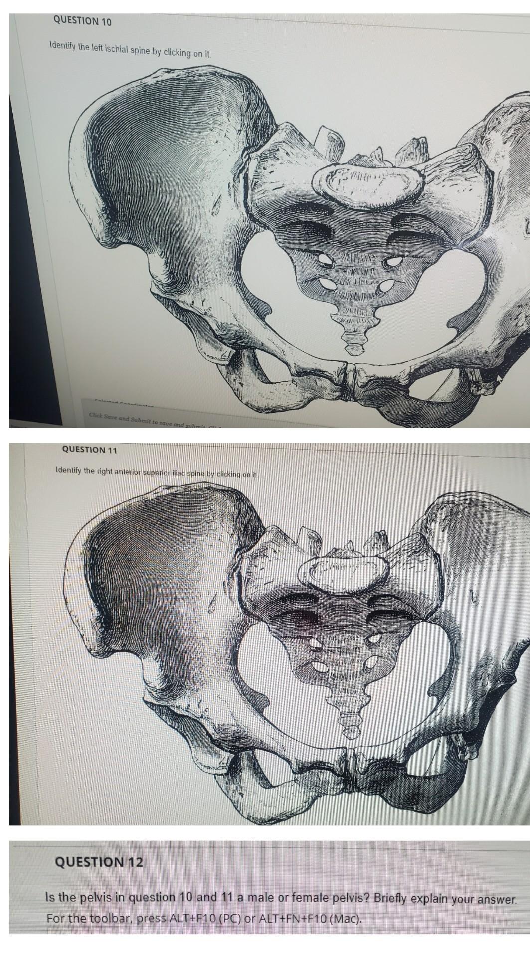 Solved QUESTION 10 Identify the left ischial spine by | Chegg.com