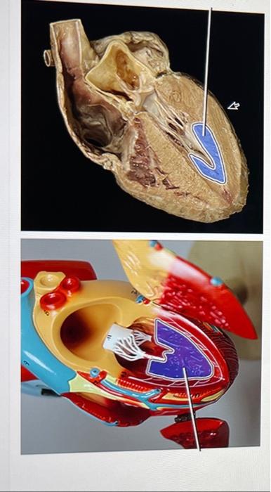 Solved Which structure is highlighted? | Chegg.com