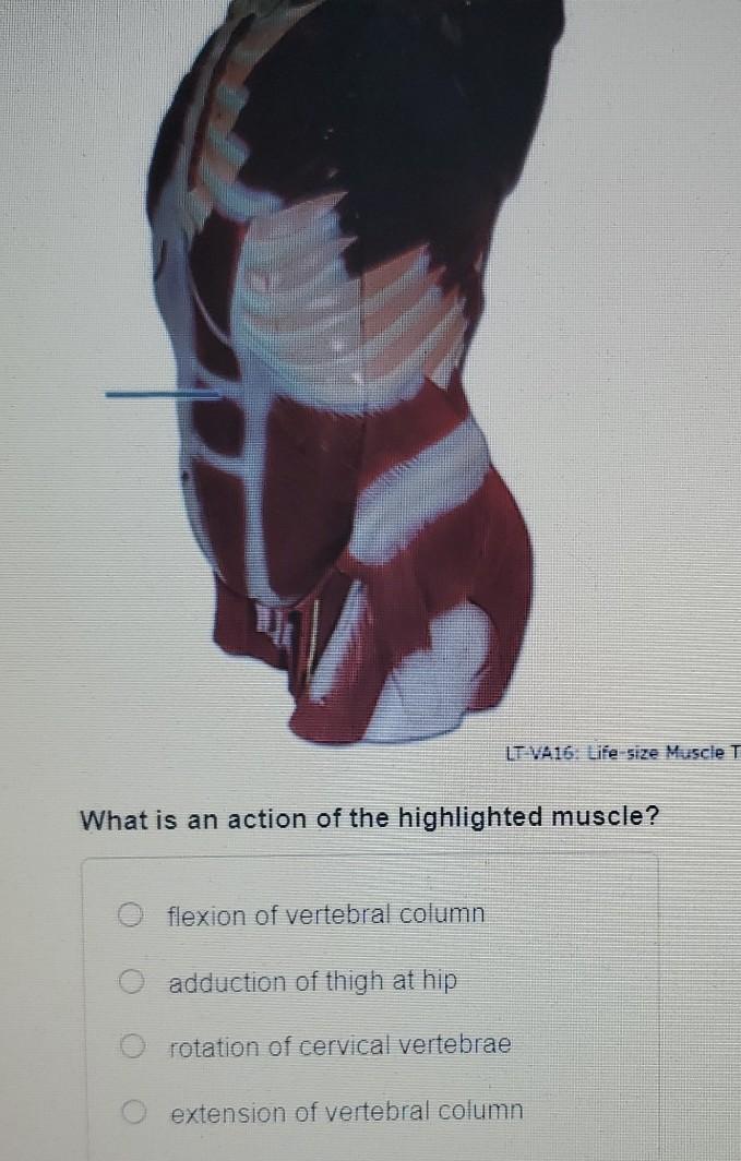 Solved Hello. Can you please identify the muscle name of the | Chegg.com