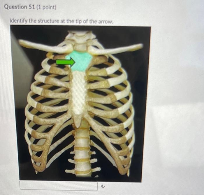 Solved Identify the body region at the tip of the | Chegg.com