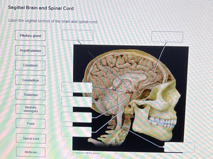 Solved Sagittal Brain and Spinal Cord Label the sagittal | Chegg.com