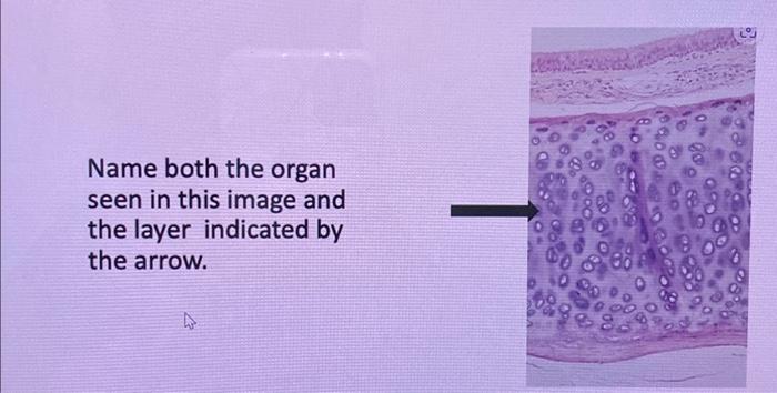 Solved Name both the organ seen in this image and the layer | Chegg.com
