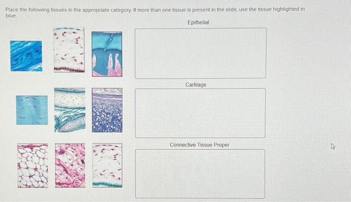Solved Place the following tissues in the appropriate | Chegg.com